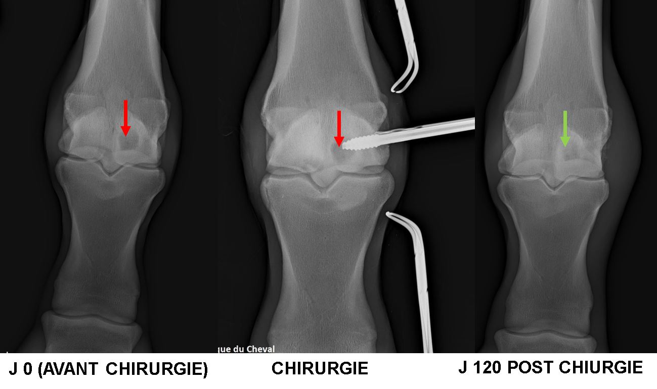 Traitement des kystes osseux sous-chondraux - La Clinique du Cheval